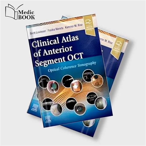 Clinical Atlas Of Anterior Segment Oct 1th Edition