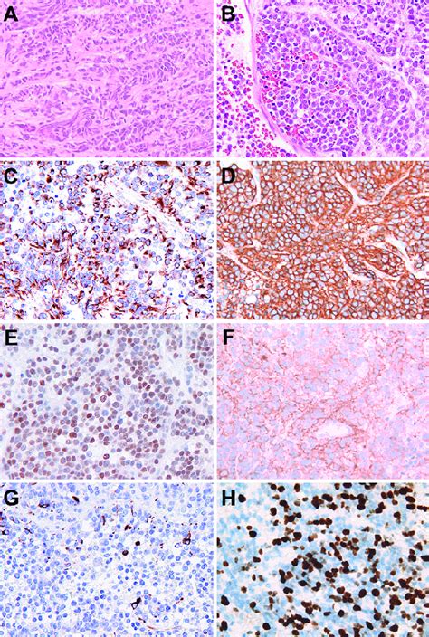 representative pathological findings hematoxylin and eosin staining