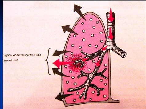 Аускультация легких Метод аускультации презентация онлайн