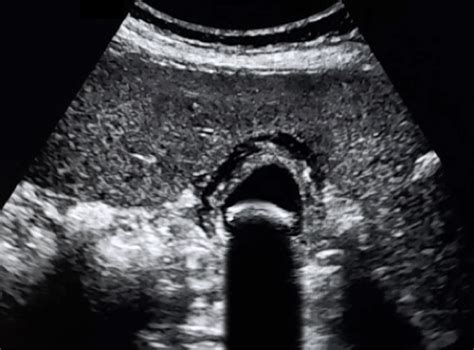 Murphy Sign Murphy Sign