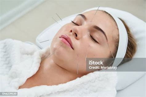 스파 살롱에서 얼굴에 침술 치료 치료를받는 젊은 여성 대체 의학 및 치료 개념 침술에 대한 스톡 사진 및 기타 이미지 침술 가꿔주기 건강관리와 의술 Istock