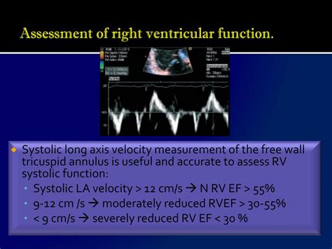 Ppt Clinical Applications Of Motion And Deformation Parameters In