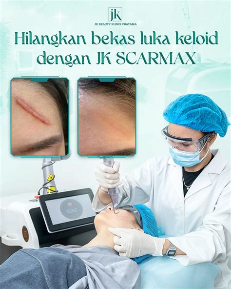 Scamax Jk Beauty Center