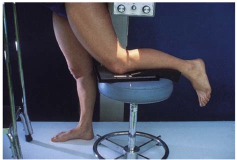 Pa Axial Projection Holmblad Method Intercondylar Fossa Flashcards