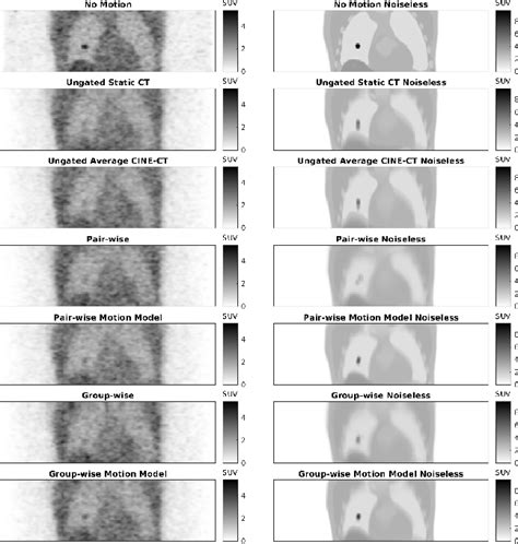 Figure 1 From Comparison Of Motion Correction Methods Incorporating