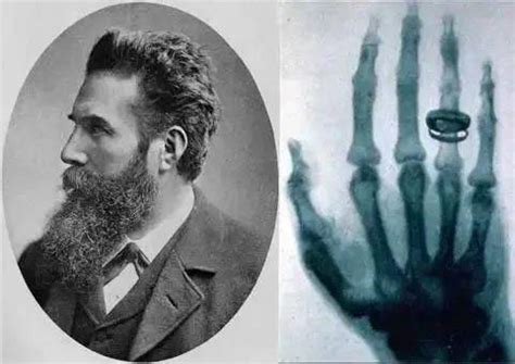 What Exactly Is The Difference Between X Rays CTs And MRIs PerLove