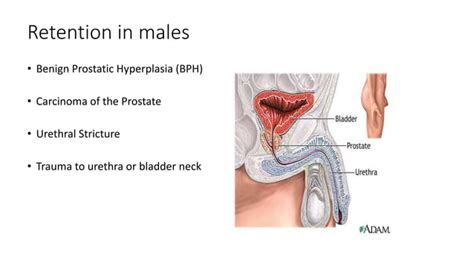 Signs And Symptoms Of Genitourinary Diseases Diseases Pptx