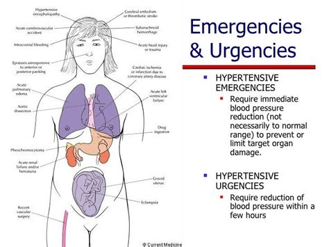 Treatment Of Hypertension Treatment Of Hypertension
