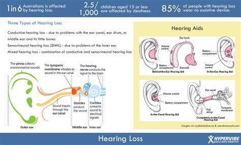 Hearing Loss Health Effects At Carolyn Pless Blog