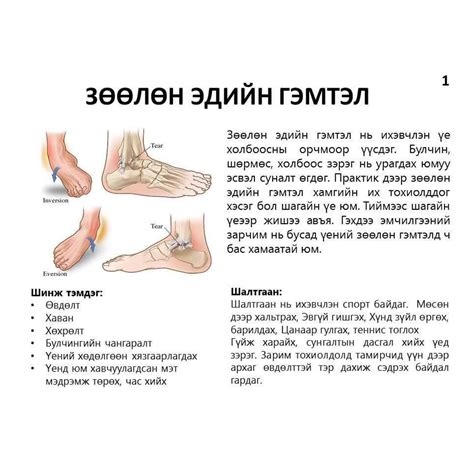 Эмчээс асууя ЗӨӨЛӨН ЭДИЙН ГЭМТЭЛ Зөөлөн эдийн гэмтэл нь