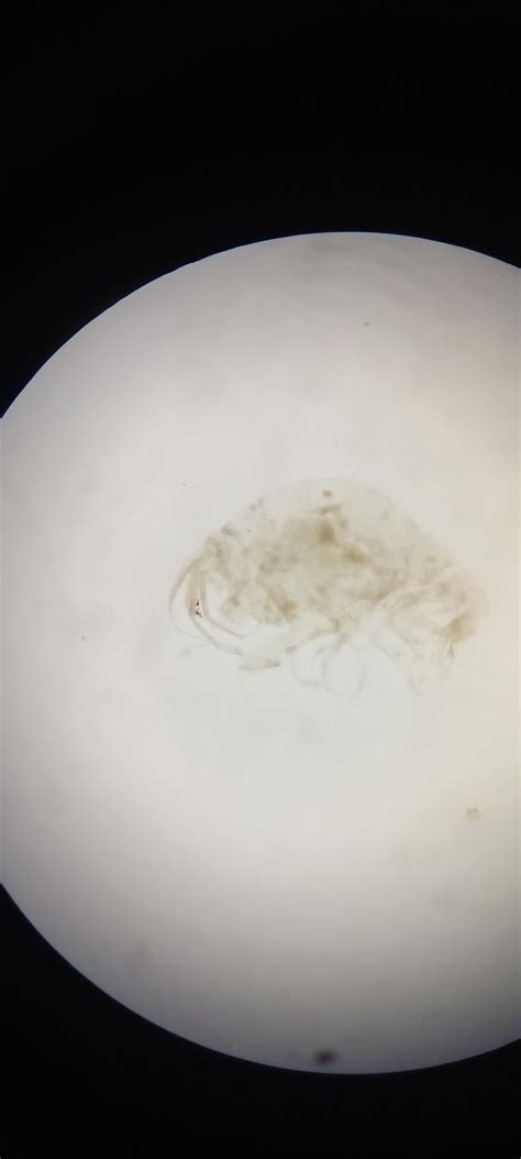 Difference Between 2 Microscopes Why Does The Second One Make The