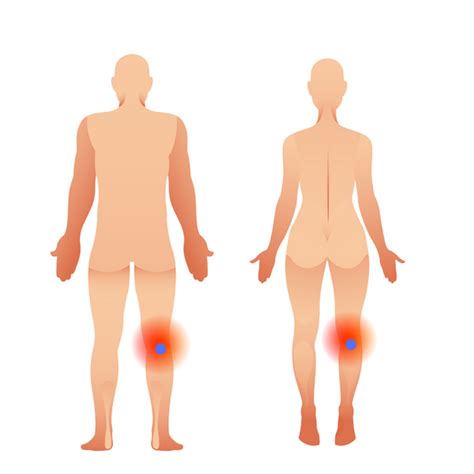 Trigger Point Therapy Knee Pain Treating Popliteus Knee