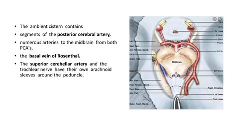 Anatomy Of Subarachnoid Cisterns Of Brain Pptx Anatomy Of Subarachnoid Cisterns Of Brain Pptx