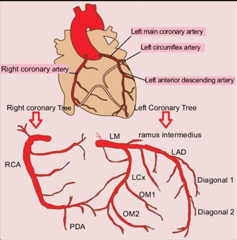 Coronary Artery Disease Flashcards Quizlet