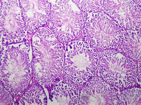 Testis Of Wistar Rat Treated With 4 Mg Kg Body Weight Of Cannabis Download Scientific Diagram
