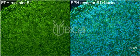EPH receptor B1 (EPHB1) antibody - BiCell Scientific®