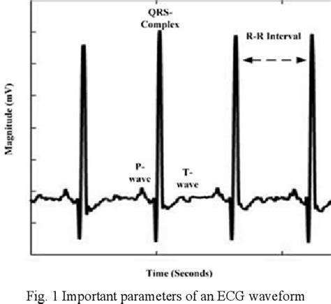 Figure 1 From ECG Based Reliable User Identification Using Deep Learning Semantic Scholar