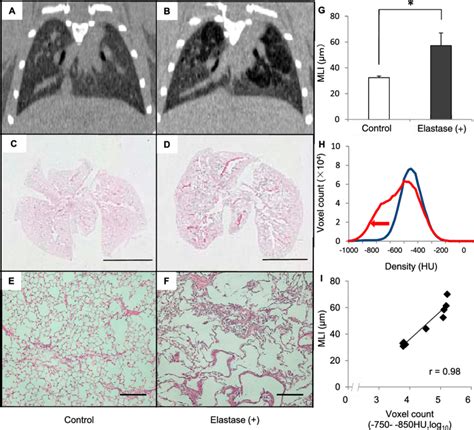 Histomorphometric Correlation With Two Dimensional Computed Tomography Download Scientific