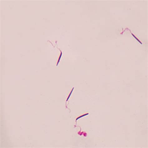 Sperm Frog Slide Cbs 203 Blades Biological Ltd Kent