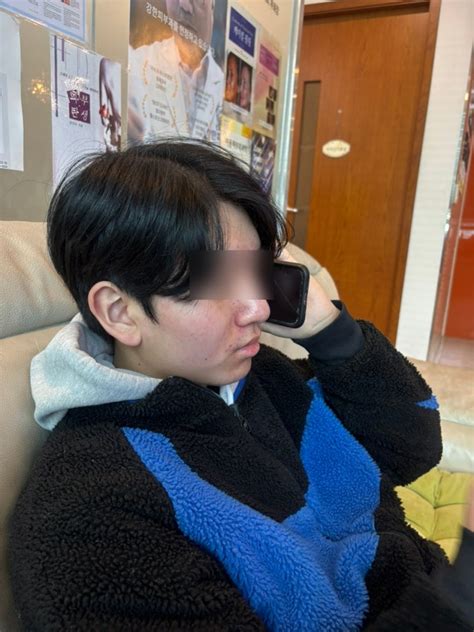 교대역 피부과 여드름 패인 흉터 레이저 치료 효과 네이버 블로그