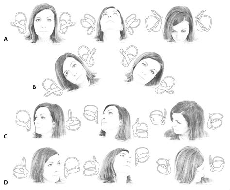 Minimum Stimulus Strategy For The Diagnosis Of Bppv Ent And Audiology News