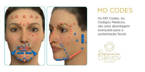 Md Codes Descubra A Revolução Da Sustentação Facial