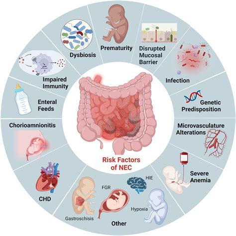 Established Risk Factors Nec Illustration Created With
