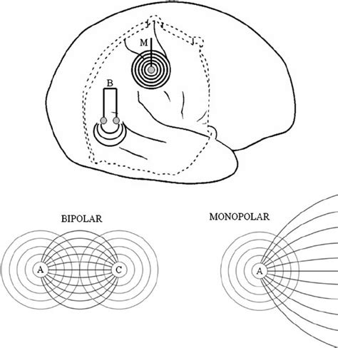 Upper Panel Schematic Drawing Showing Bipolar B And Monopolar M