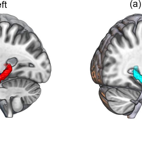 The Seed Regions For Dynamic Fc Analyses The Four Subregions Of Hpc