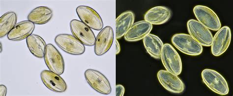 Pollen Microscopy Of Nature