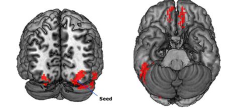 Spatial Coding And Similar Spatial Patterns In The Brain Part 2