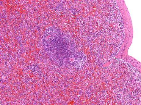 Spleen Histology White Pulp