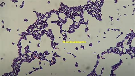 Gram Positive And Gram Negative Bacteria Introduction Differenc