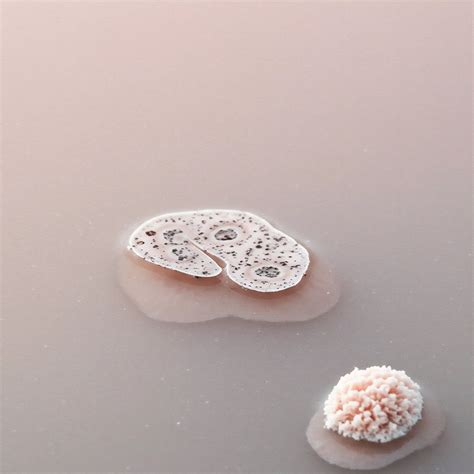 Psychological Toll → Term