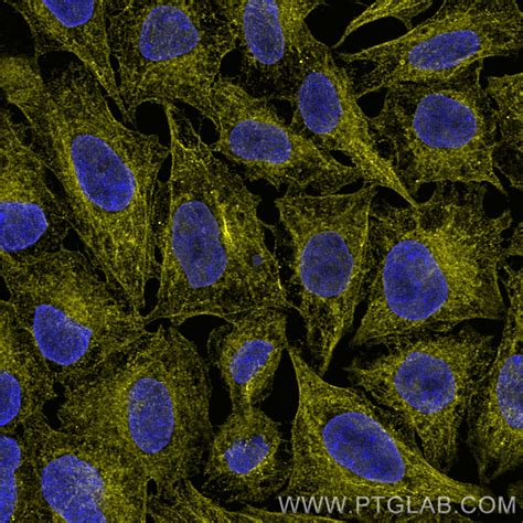 Flexable Biotin Antibody Labeling Kit For Mouse Igg2b Kfa067 Proteintech
