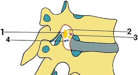 Intervertebral Foramen Contents Intervertebral Foramen Contents