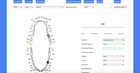 Underbite Veterinary Dental Charting Software
