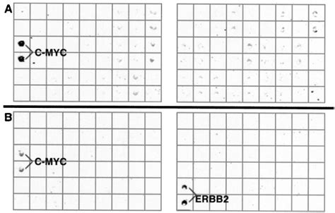Two Examples Of The Genomic Hybridization On Cdna Arrays A High Level