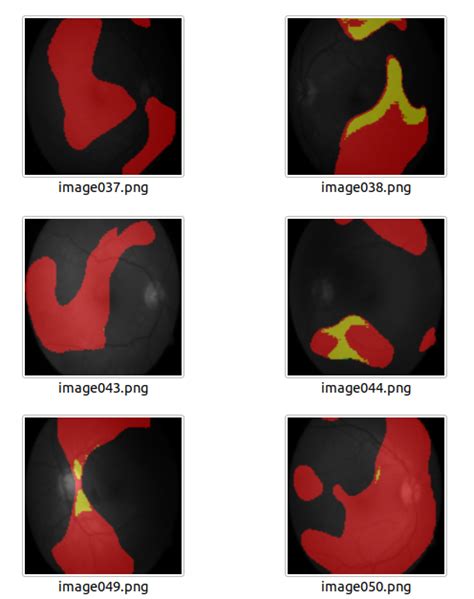 Github Sohiniroychu Net For Multi Class Semantic Segmentation