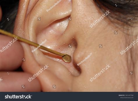 Celebrity Ear Wax