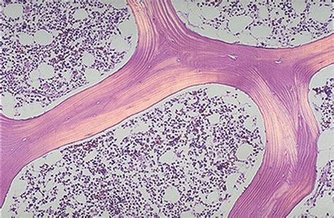 Trabeculae Histology