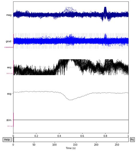 Scaling Label Overplotting In Rawplot · Issue 10128 · Mne Toolsmne