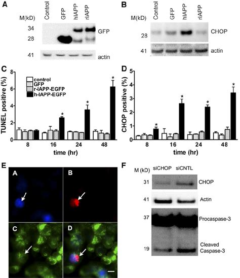 Human Iapp Induced Chop Expression Precedes Apoptosis In Human Iapp