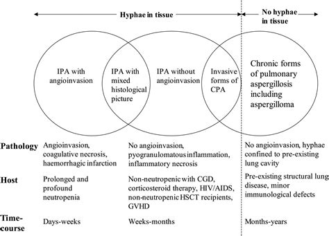 The Clinical Spectrum Of Pulmonary Aspergillosis Thorax
