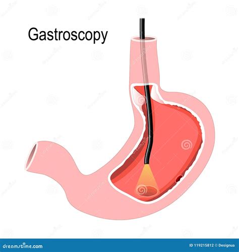 Panendoscopy Cartoons Illustrations And Vector Stock Images 9 Pictures To Download From