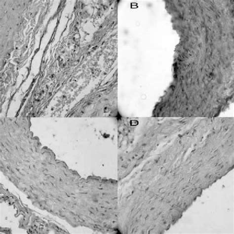 Il 1β Immunostaining A Group S Dab X 40 B Group C Dab X 100 C
