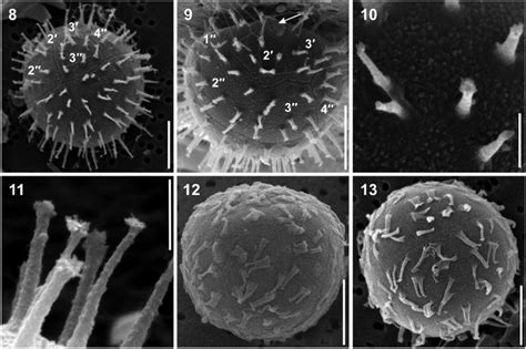 Cysts Of Pyrodinium Bahamense Under Scanning Electron Microscopy 8