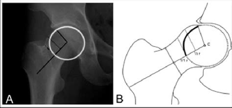 A 2B Measurements Of The Radial Height Radius Ratio R1 And 1 2 Download Scientific Diagram