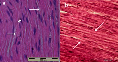 light micrographs of the distal segment of the sciatic nerve on day 112