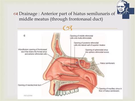 Anatomy Of Paranasal Air Sinuses Pptx